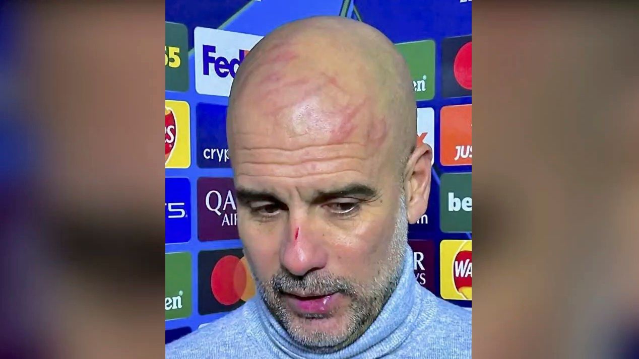 ¿Qué pasó con Pep Guardiola? Sale a conferencia rasguñado