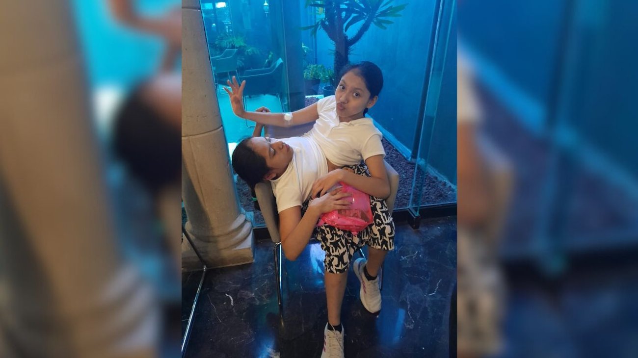 Secretaría de Igualdad se une a pedir apoyo para siamesas regias