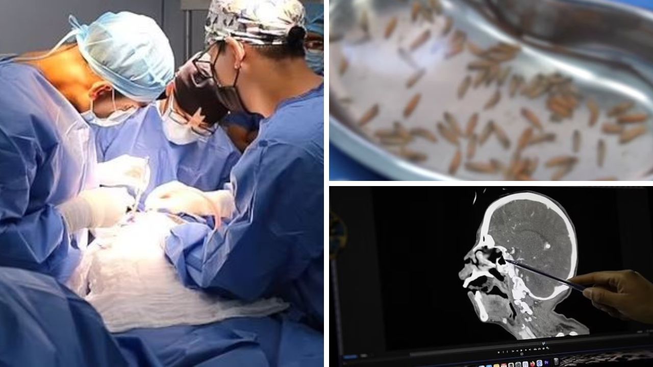 Le extraen 150 larvas de la boca tras procedimiento dental